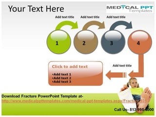 Fracture PowerPoint Template- Medical PPT Templates | PPTX