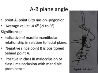 Downs analysis | PPTX