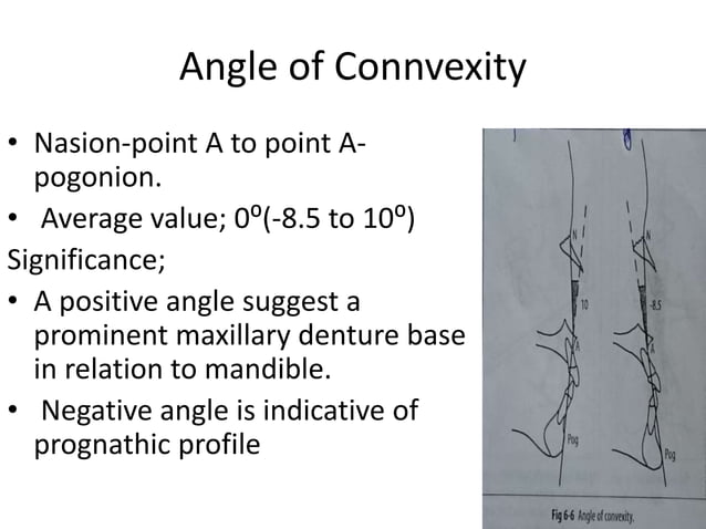Downs analysis | PPTX | Dental Health | Diseases and Conditions