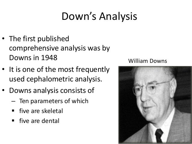 Downs analysis