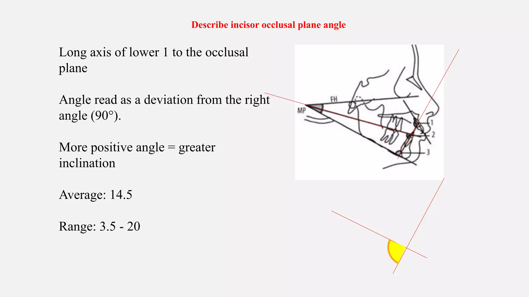 Downs analysis in orthodontics (Nay Aung, PhD).pdf