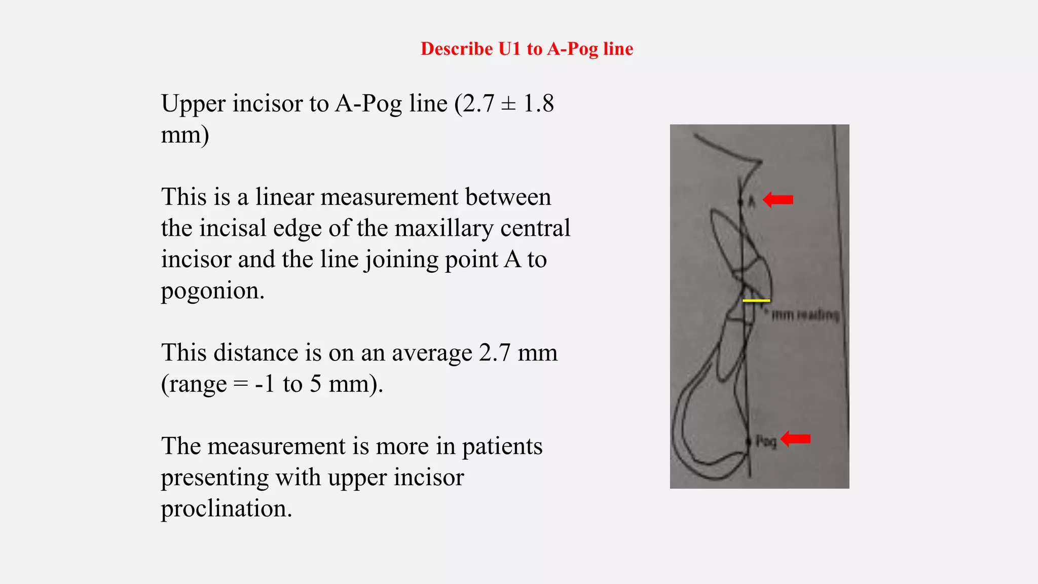 Downs analysis in orthodontics (Nay Aung, PhD).pdf