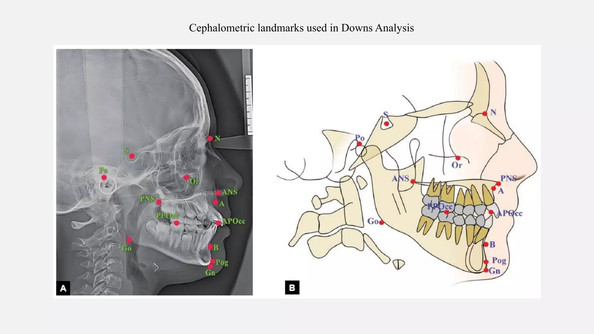 Downs analysis in orthodontics (Nay Aung, PhD).pdf