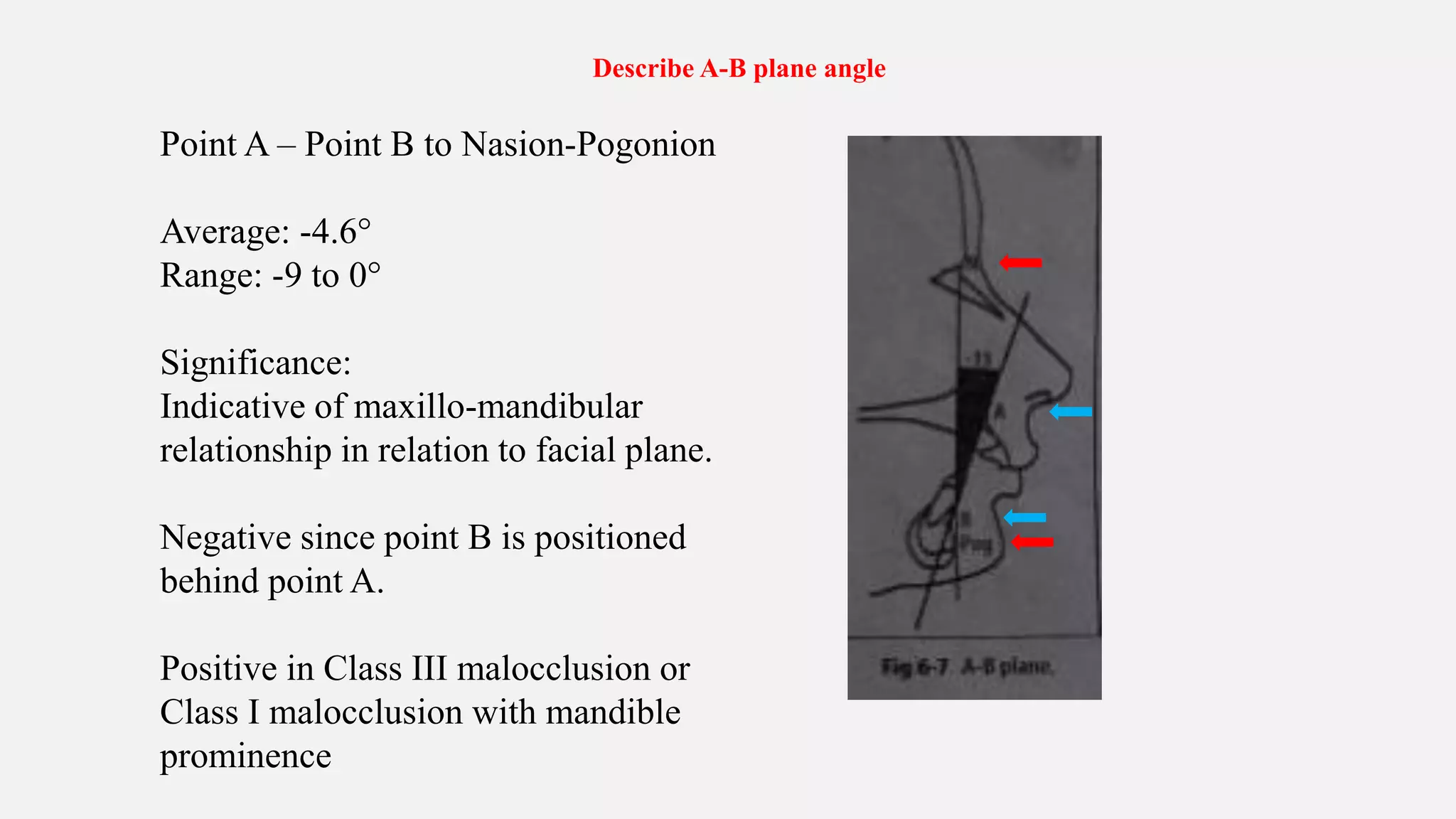 Downs analysis in orthodontics (Nay Aung, PhD).pdf