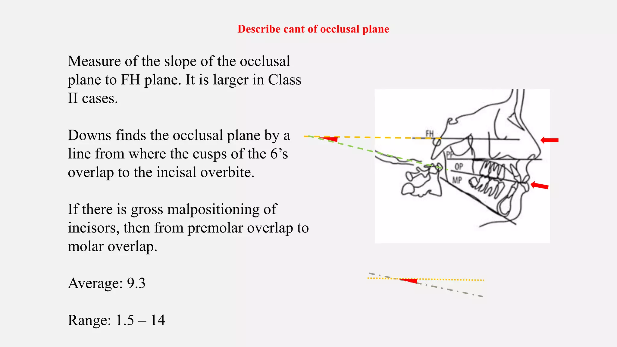 Downs analysis in orthodontics (Nay Aung, PhD).pdf