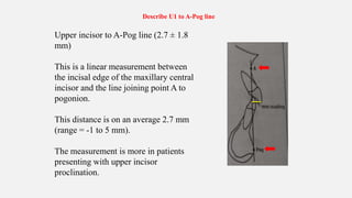 Downs analysis in orthodontics (Nay Aung, PhD).pdf