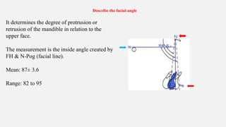 Downs analysis in orthodontics (Nay Aung, PhD).pdf