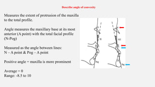Downs analysis in orthodontics (Nay Aung, PhD).pdf