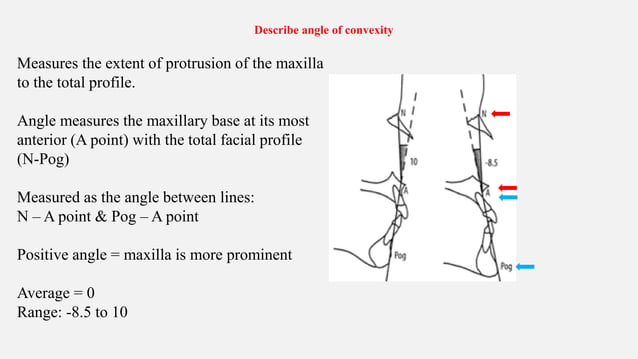 Downs analysis in orthodontics (Nay Aung, PhD).pdf | Dental Health ...