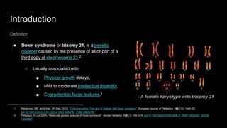Down Syndrome | PPT