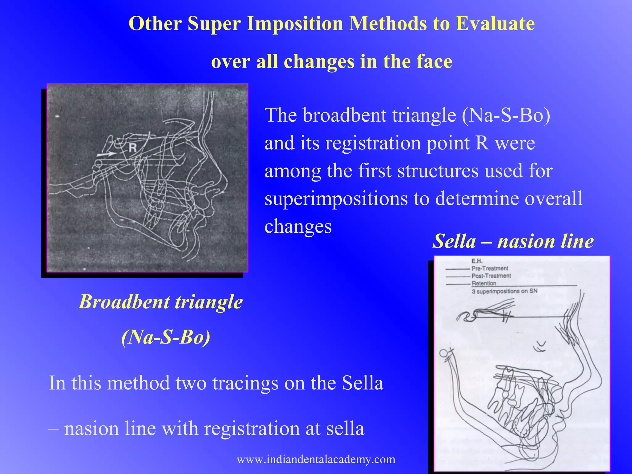 Down's,ricket's & cephalometric superimposition /certified fixed ...