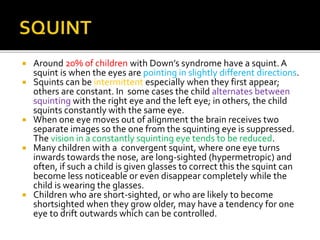 Down’s syndrome | PPTX