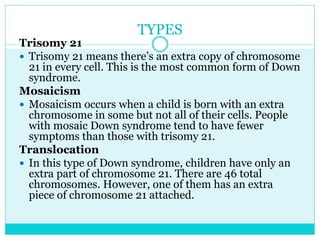 Downs syndrome | PPTX