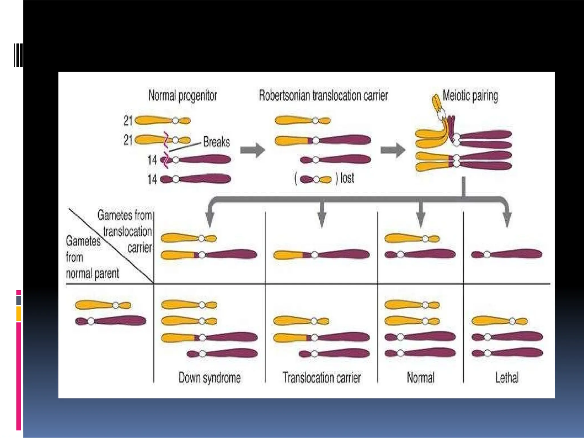 Downs syndrome Treatment and Diagnosis (trisomy 21) | PPTX
