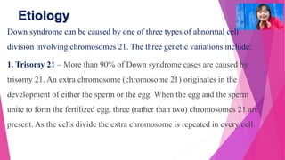 down syndrome.pptx
