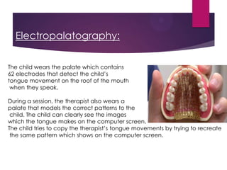 Down syndrome & Role of Technology | PPTX