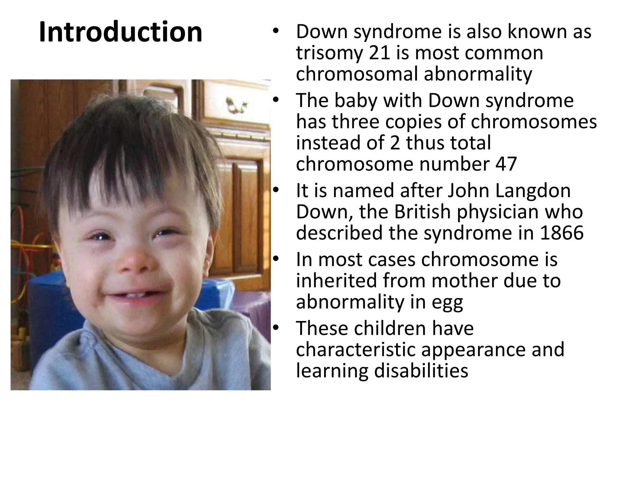 down syndrome-03.ppt for B. Sc Nursing students | PPT