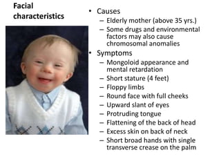 down syndrome-03.ppt for B. Sc Nursing students | PPT