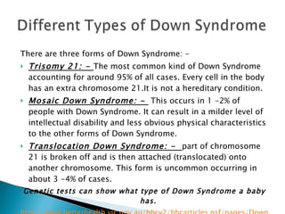 Down Syndrome | PPT