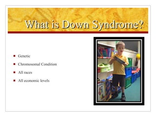 Down Syndrome | PPT