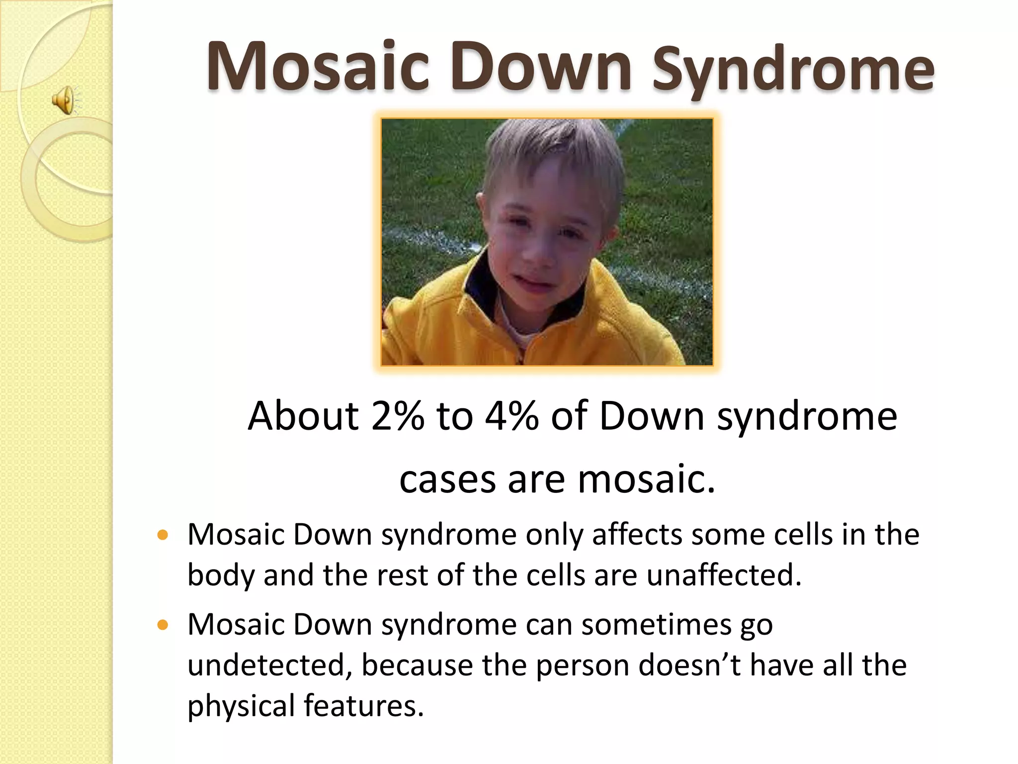 Down Syndrome | PPTX
