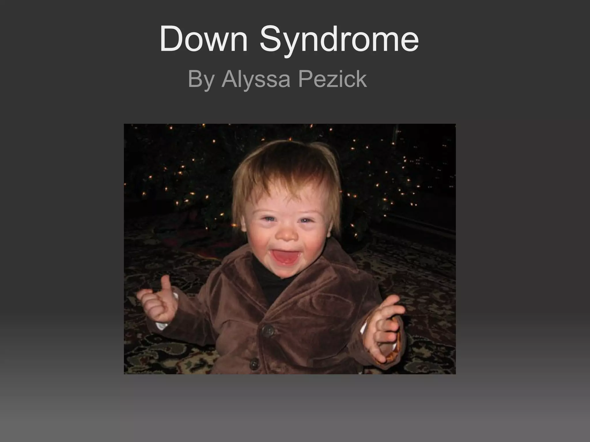 Down syndrome | PPT