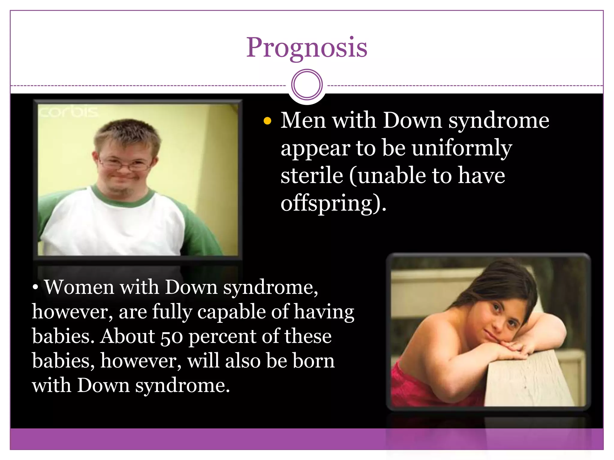 Down syndrome Characteristics, Diagnosis, Prognosis, Treatment | PPTX