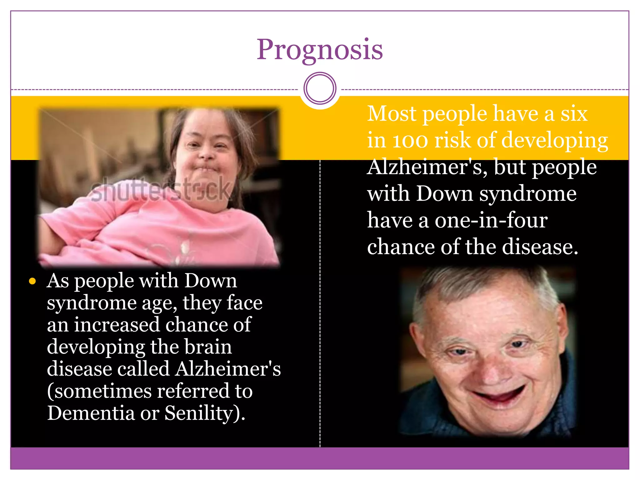 Down syndrome Characteristics, Diagnosis, Prognosis, Treatment | PPTX