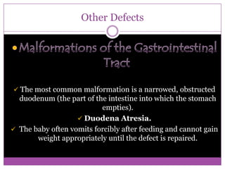 Down syndrome Characteristics, Diagnosis, Prognosis, Treatment | PPTX