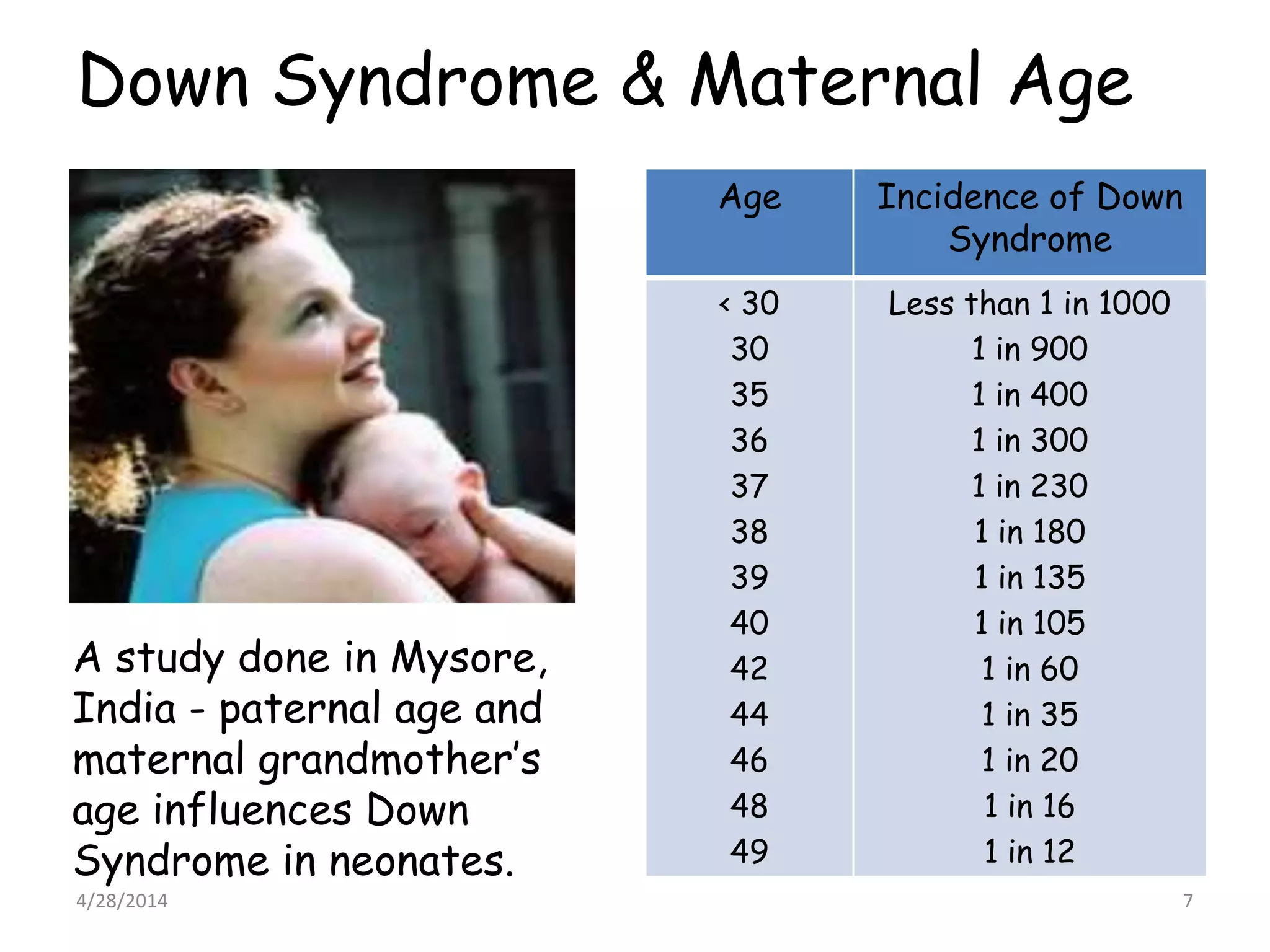 Down syndrome ppt for UGs | PPTX