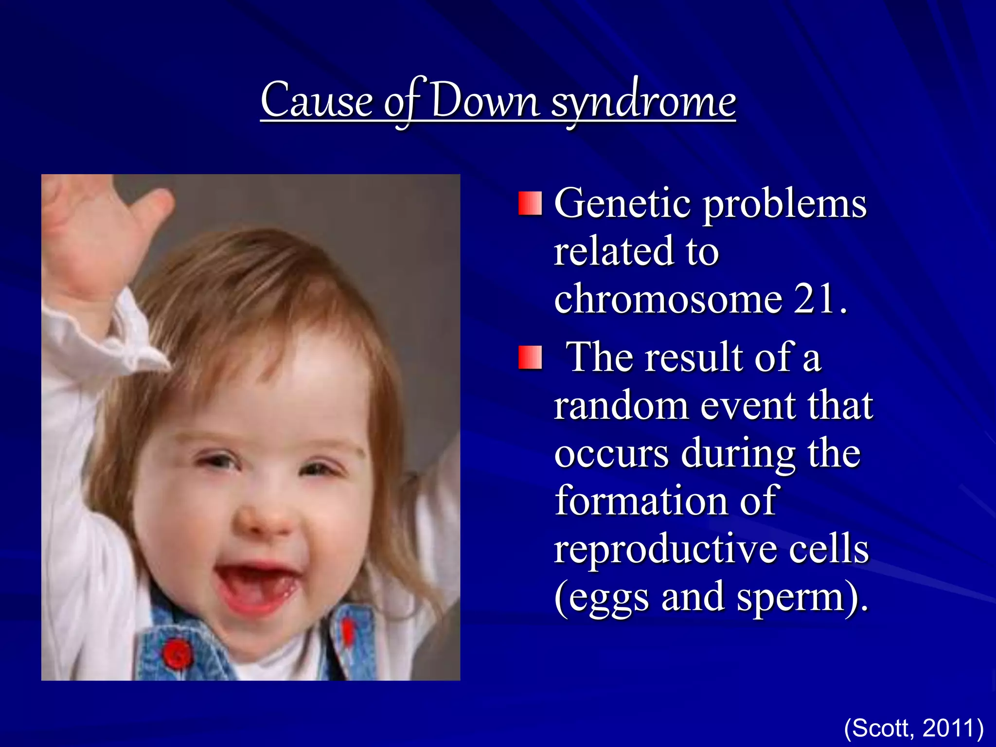 Down syndrome Power Poiny (Biology) | PPTX
