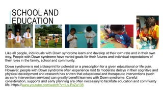 Down syndrome | PPT