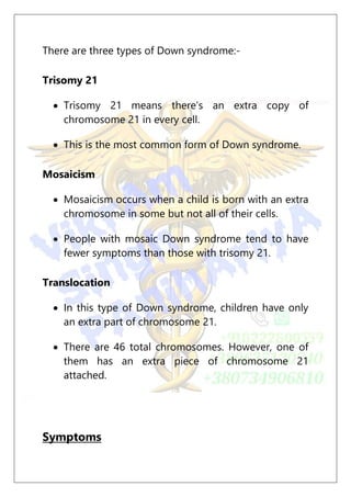 Down syndrome | PDF
