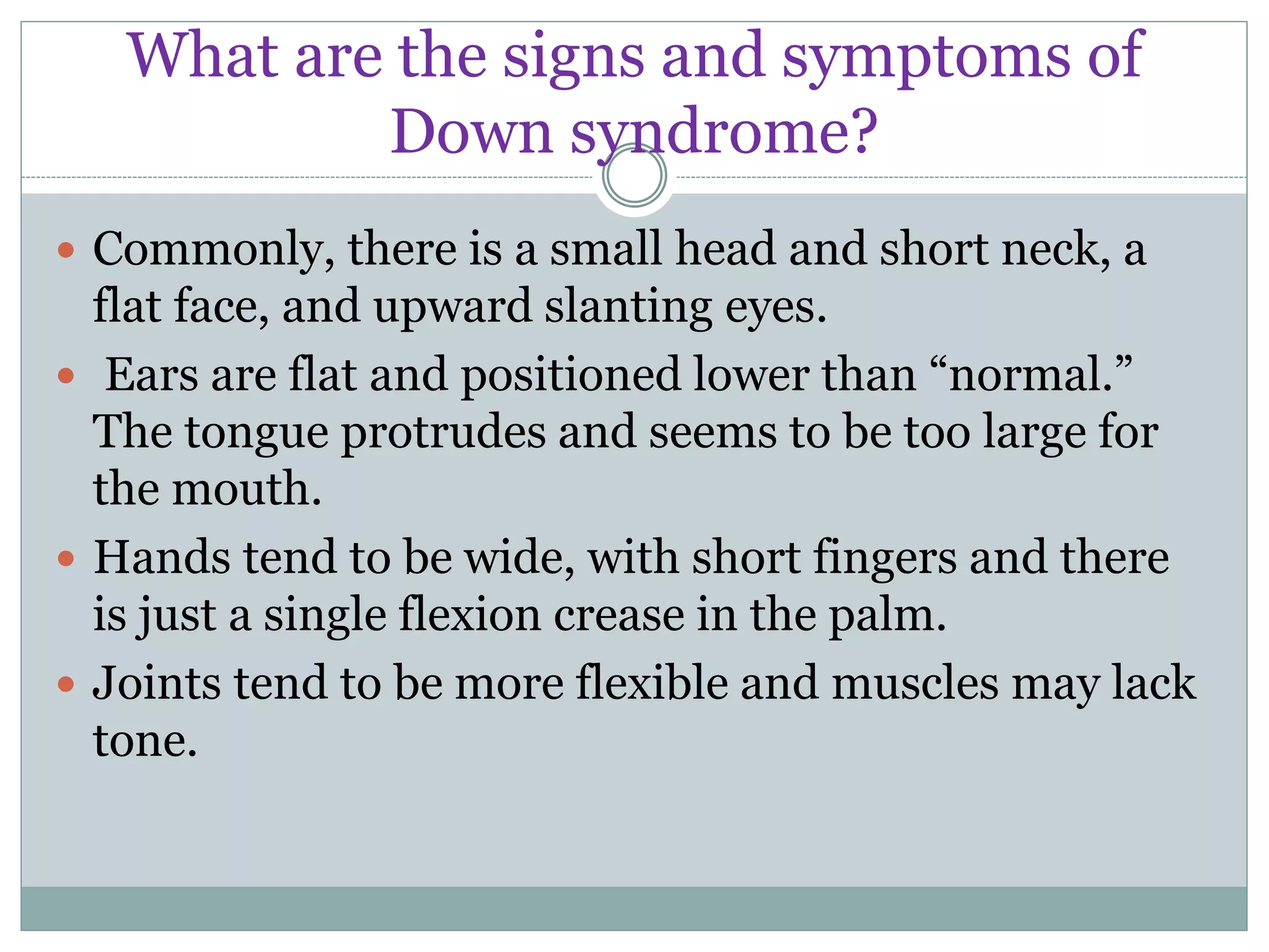 Down syndrome | PPTX