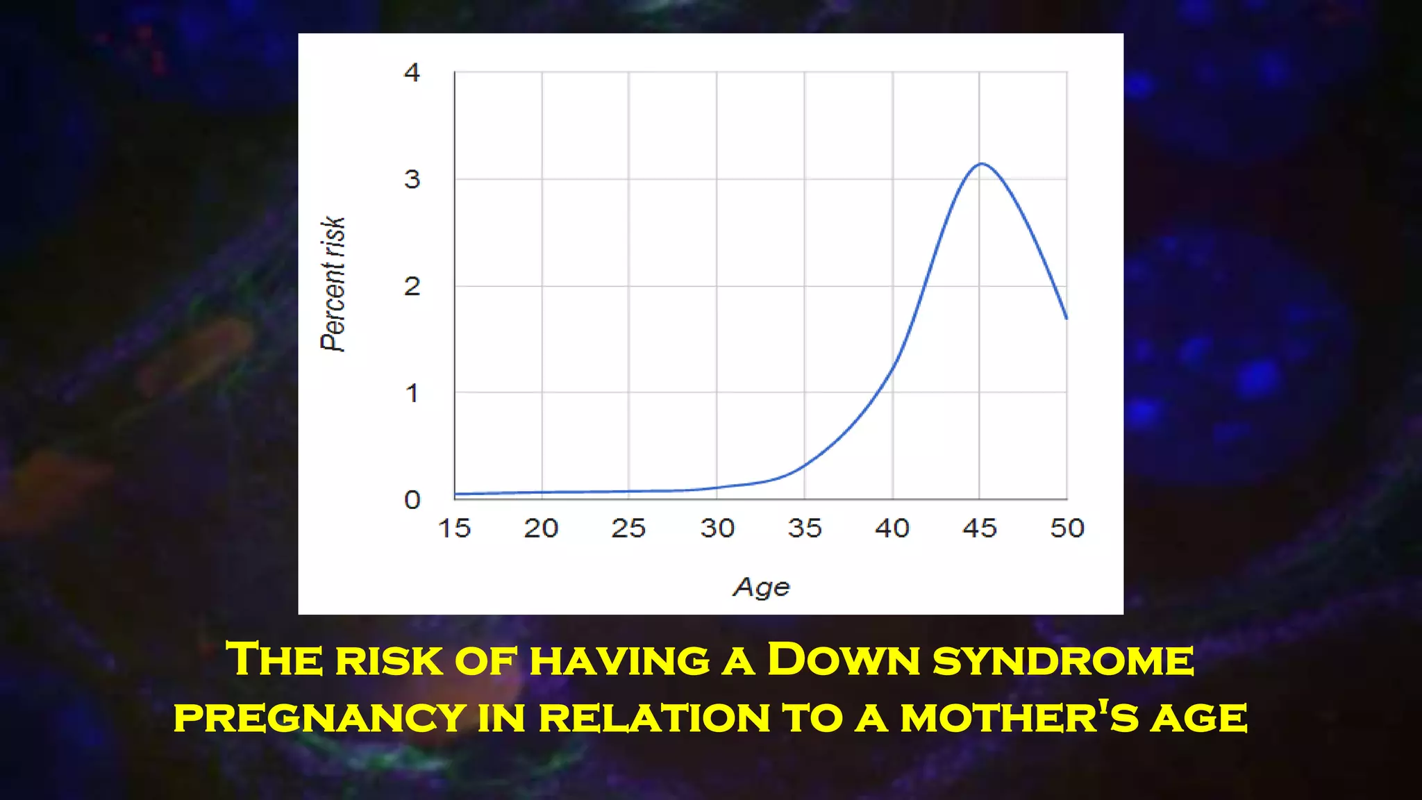 Down syndrome | PPTX