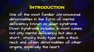 Down syndrome | PPTX