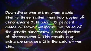 Down syndrome | PPTX