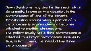 Down syndrome | PPTX