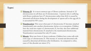Down syndrome | PPTX
