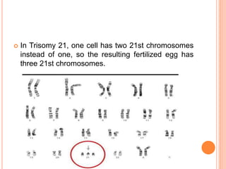 Down syndrome | PPTX