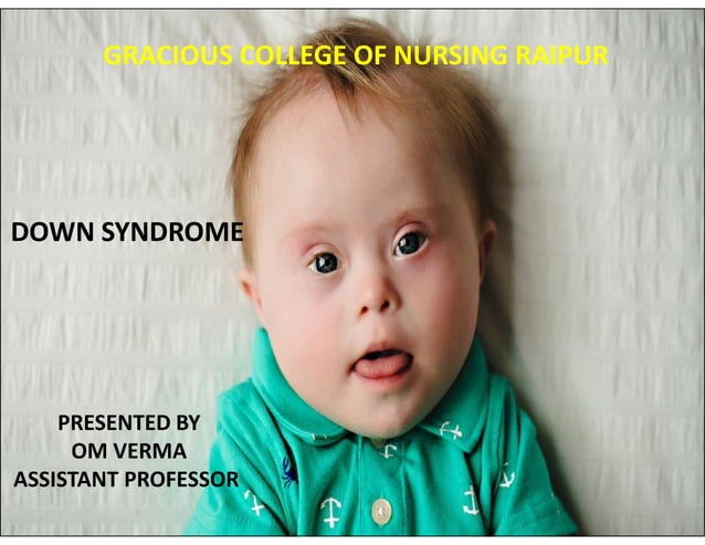 DOWN SYNDROME.pdf