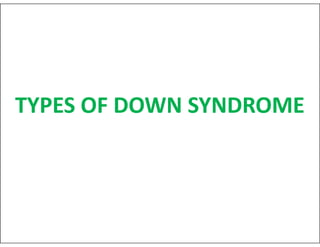 DOWN SYNDROME.pdf