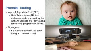 Down's Syndrome.pptx