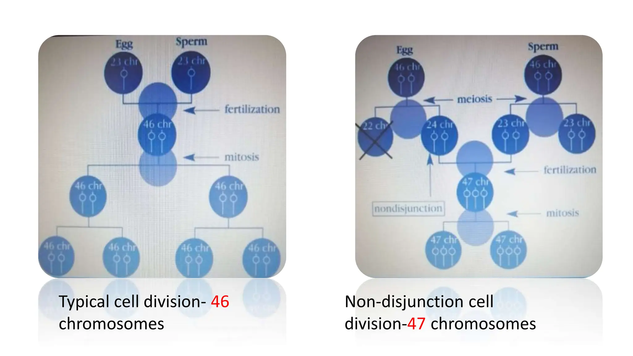 DOWN SYNDROME.pptx............................. | PPTX