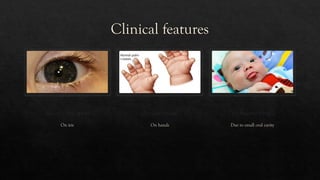 Down syndrome. pdf diagnosis and screening by DR. Khansa | PPTX