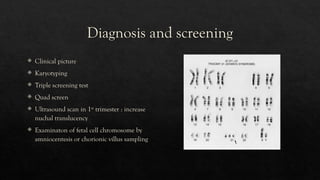 Down syndrome. pdf diagnosis and screening by DR. Khansa | PPTX