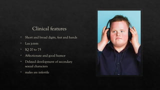 Down syndrome. pdf diagnosis and screening by DR. Khansa | PPTX