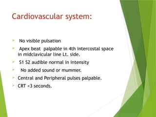 (Down Syndrome).pptxDown syndrome characteristics feature clinical ...