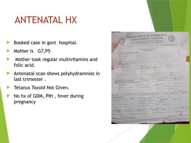 (Down Syndrome).pptxDown syndrome characteristics feature clinical ...