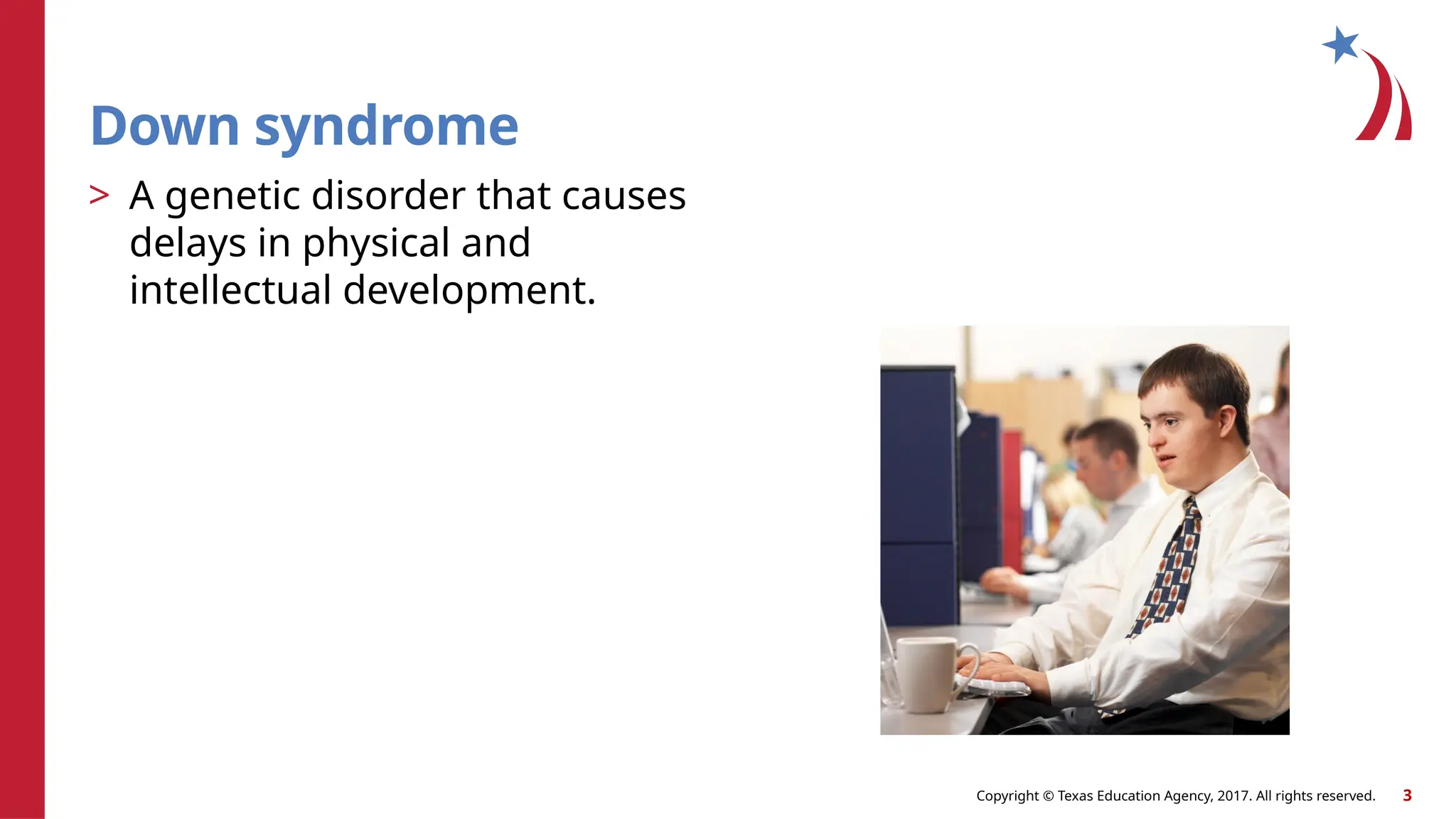 Down Syndrome.pptx genital disorder, types, clinical manifestation, | PPTX